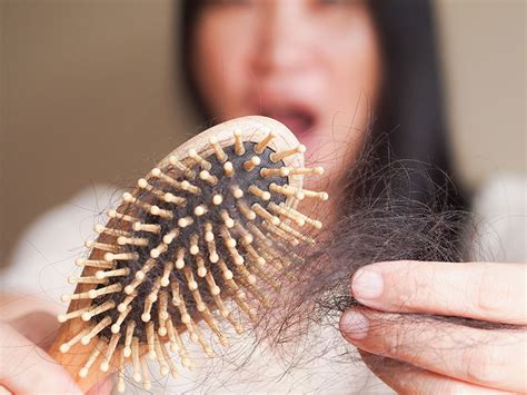 Naglalagas Na Buhok Mga Tips Kung Pano Ito I Manage