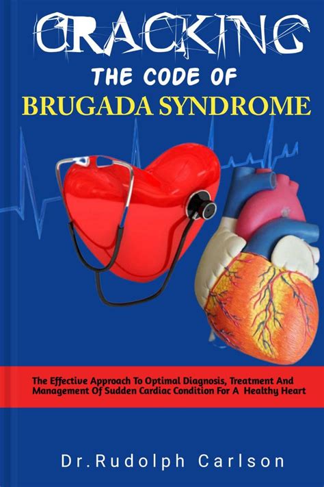 Cracking The Code Of Brugada Syndrome The Effective