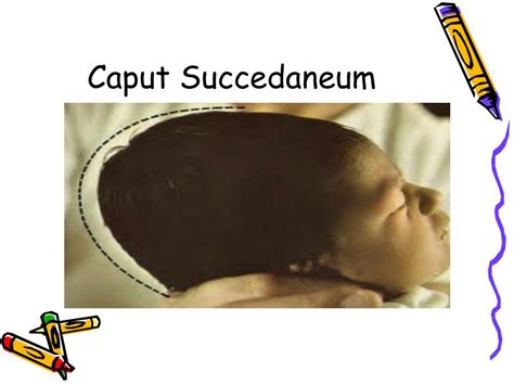 Ppt The Newborn Physical Exam Powerpoint Presentation Free Download Id 6891815