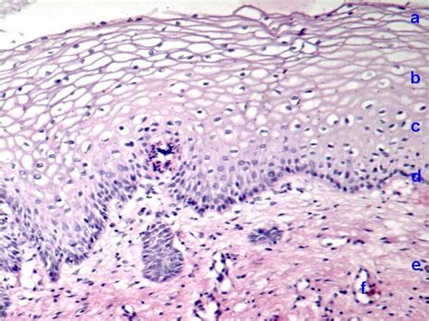 Colposcopy Digital Atlas