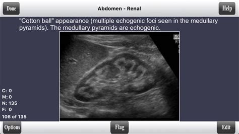Arrt Sonography Ultrasound Flashcards By Virtual Flashcards