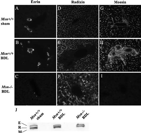 Erm Expression In Mouse Liver A I Immuno Fl Uorescent Micrographs