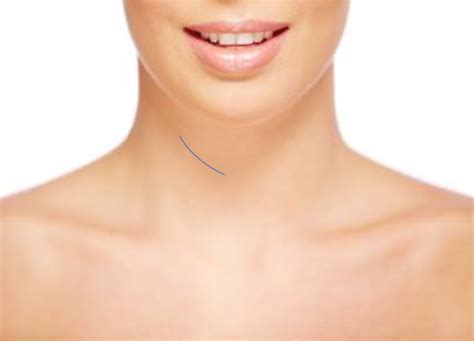 Canal Cervical étroit Chirurgie Orthopédique