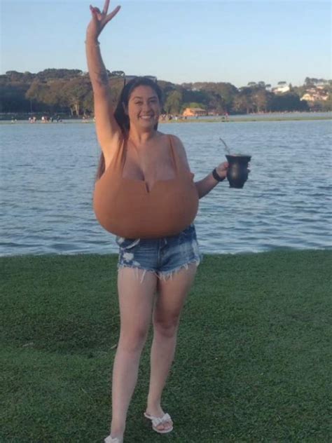 Brazilian Woman One Of 300 Women Diagnosed With Breast Issue The