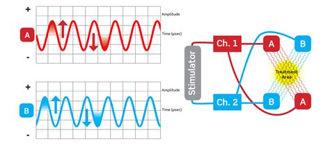 How To Compare Tens Units A Review Of 5 Signal Types