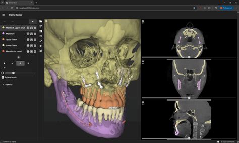 Trame Slicer Bringing The Power Of 3d Slicer To The Web