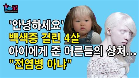 안녕하세요 백색증 걸린 4살 아이에게 준 어른들의 상처 전염병 아냐 Youtube