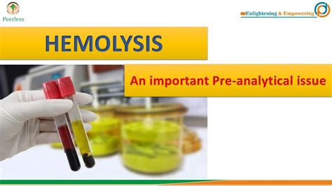 Hemolysis A Potential Pre Analytical Issue In Diagnostic Laboratory Youtube