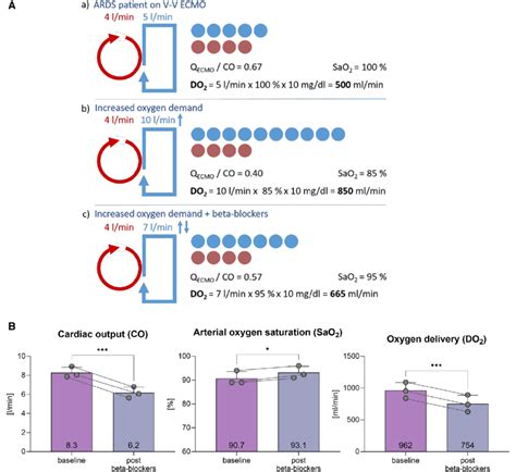 A Schematic Representation Of Ecmo Flow And Cardiac Output Red