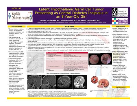 Pdf Latent Hypothalamic Germ Cell Tumor Presenting As Central Di
