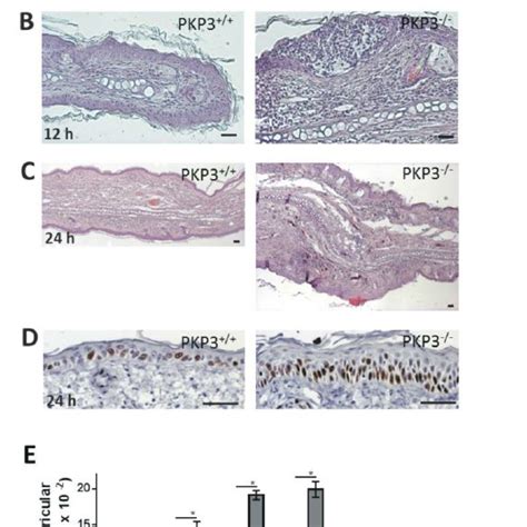 Pkp3 Deficiency Exacerbates Erythema Tissue Swelling And Epidermal Download Scientific Diagram