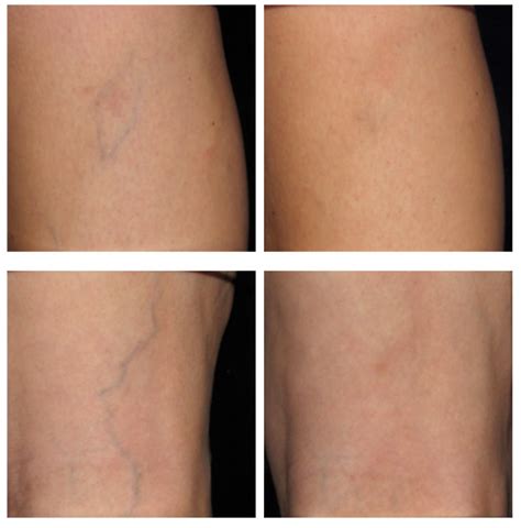 Medical Skin Boutique Sclerotherapy