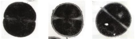 Representative Transmission Electron Micrographs And Cell Wall Download Scientific Diagram