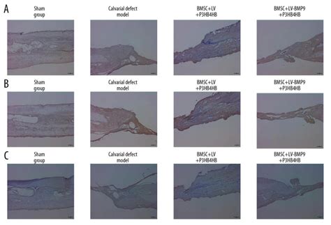 A Composite Tissue Engineered Bone Material Consisting Of Bone