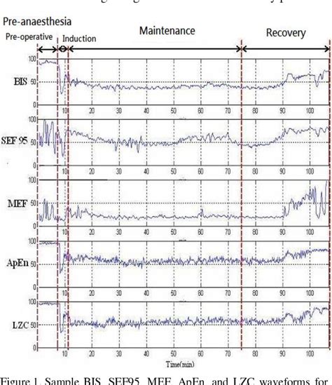 Figure 1 From Comparison Of Eeg Approximate Entropy And Complexity