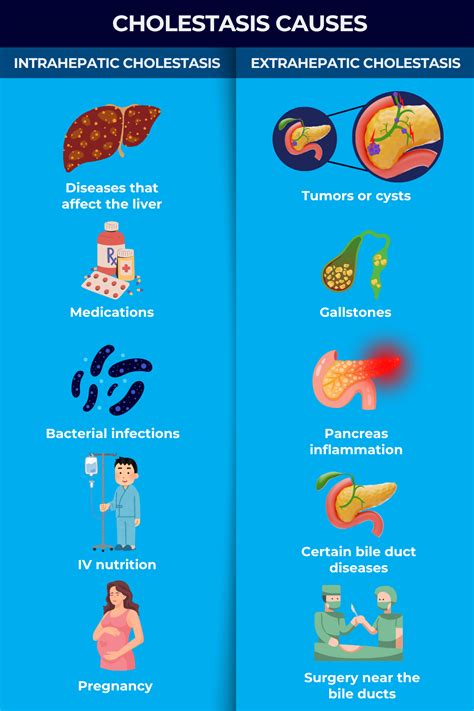 Cholestasis Causes And Risk Factors Liver Disease News