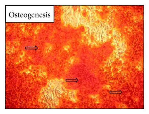 Isolation And Trilineage Differentiation Of Mouse Bone Marrow Mscs