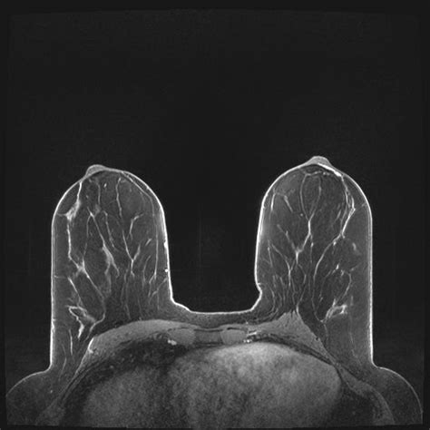 Body Mri Charter Radiology