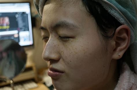 Acne04 Object Detection Model V1 2023 01 30 12 23pm By Andrei Dore