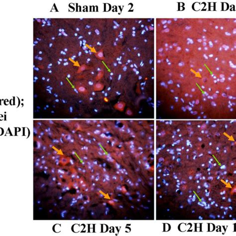 Ihc Of Bdnf Expression In Ipsilateral Segments Of Sham And C2 Download Scientific Diagram