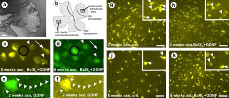 Retinal Transduction By Intravitreal Application Of 1 107 Transducing