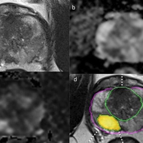 The Structure Diagram Of Efficientnet Smaller Efficientnet Smaller Is