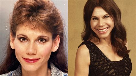 Has Theresa From Golden Bachelor Had Plastic Surgery