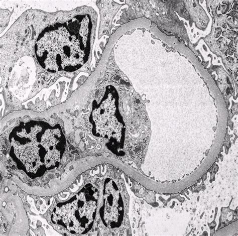 Glomerular Electron Micrograph Diagram Quizlet