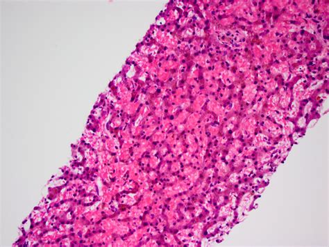 Liver Histology Sinusoids