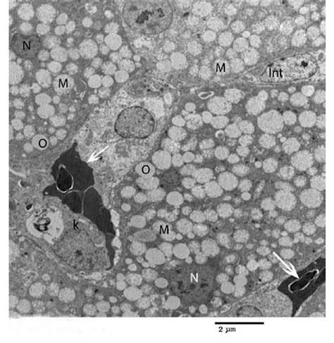 Transmission Electron Micrograph Of The Hepatocyte Of Chicks