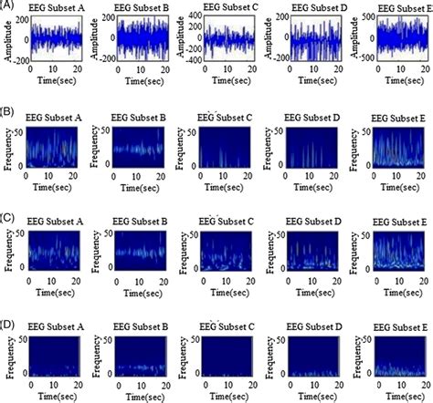 A Electroencephalogram Eeg Segments Of All Sets B Optimized Download Scientific Diagram