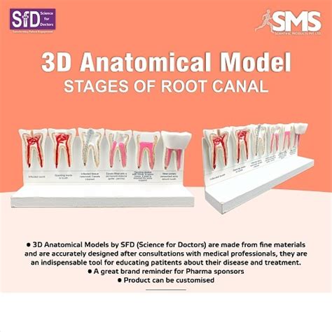 3d Anatomical Model Stages Of Root Canel At Best Price In Mumbai Sms Scientific Products Pvt Ltd