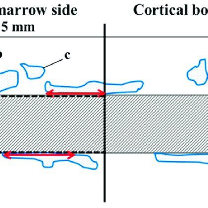 Schema Of Bone Implant Contact Bic Measurement Range A Length Of