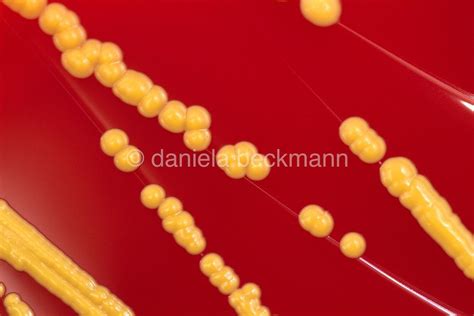 Micrococcus Spp By Daniela Beckmann Rmacropod