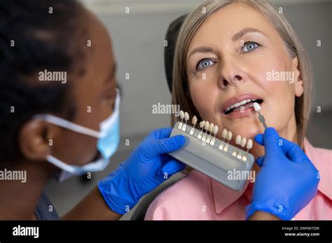 Woman Dentist Holding Dental Teeth Shade Guide Chart Choosing Right
