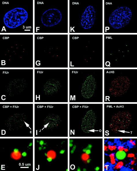 Digital Deconvolution Microscopy Of Sk N Cells Pulsed With Fu For 2