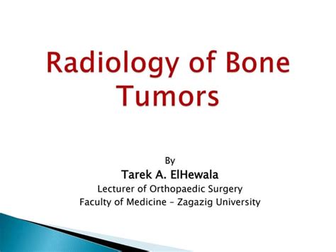 Radiology Of Bone Tumours Pptx