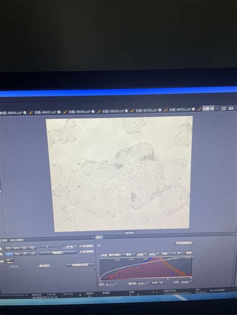 Poor Status Of Cultured Ipsc Contamination Or Differentiation