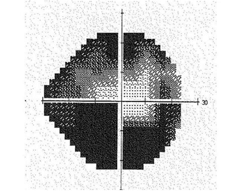 Divya Drashti Eye Hospital