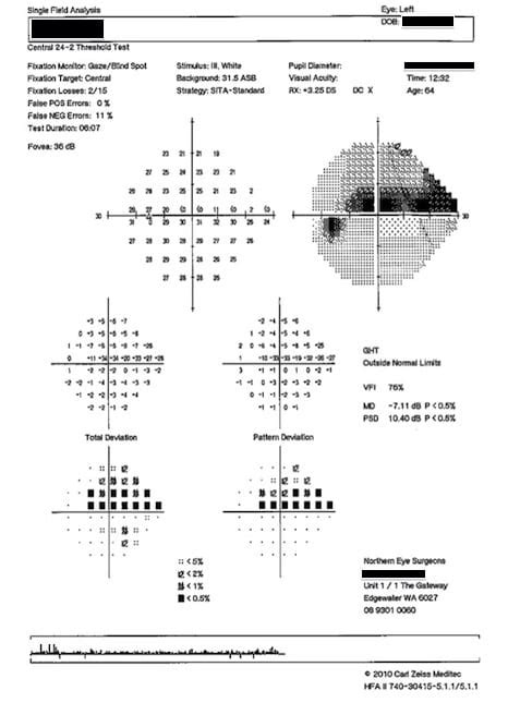 Northern Eye Surgeons Visual Field Testing