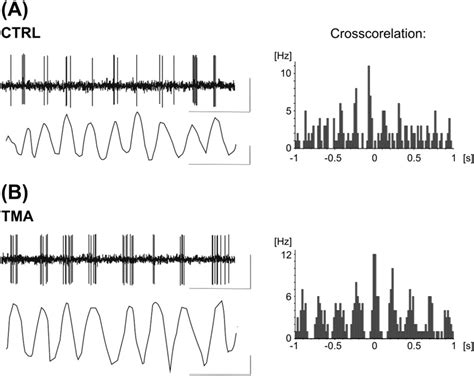 Analogue Examples At Thomas Simpson Blog