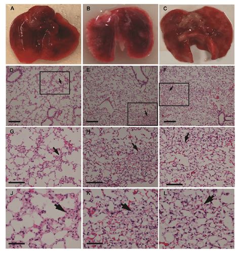 Gross Appearance And Histology Of The Lungs Of Scid Mice Injected With Download Scientific