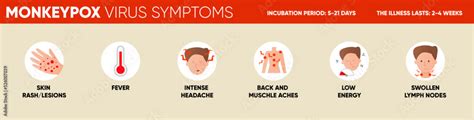 Poster Monkeypox Virus Symptoms Simple Infographic Wall Art Ukposters