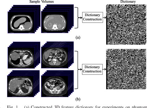 Figure 1 From 3d Feature Constrained Reconstruction For Low Dose Ct Imaging Semantic Scholar