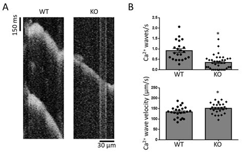 Arrhythmogenic Ca²⁺ Waves In Wt And Gq Ko Mice A Ca²⁺ Wave Frequency Download Scientific