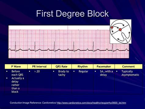 Basic Ecg Rthym Rajipptx Acls Preparation Ppt