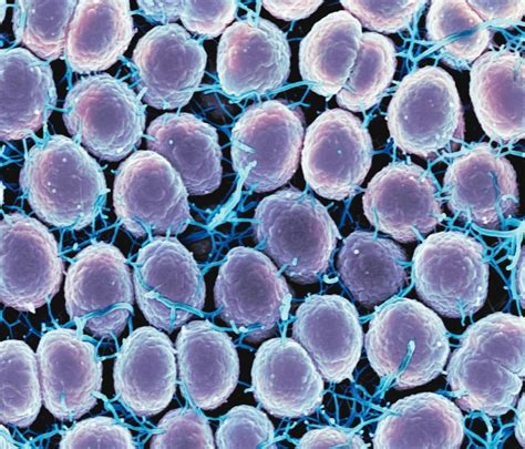 What Are The Different Strains Of Hpv High Risk Vs Low Risk Std