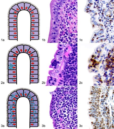 High Lymphocyte Count In Cat