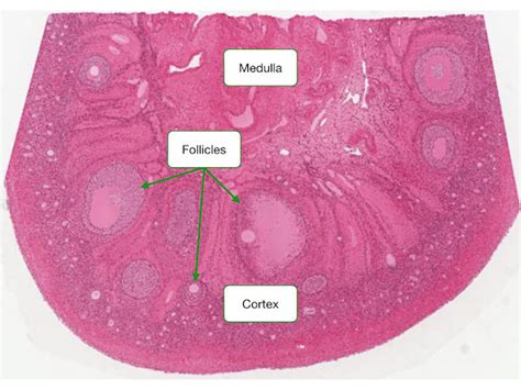 Labeled Graafian Follicle