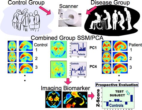 identification of disease related spatial covariance patterns using